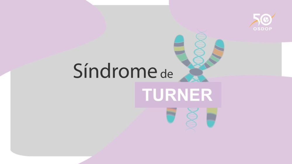 Cómo Entender y Tratar el Síndrome de Turner: Consejos Prácticos para ...