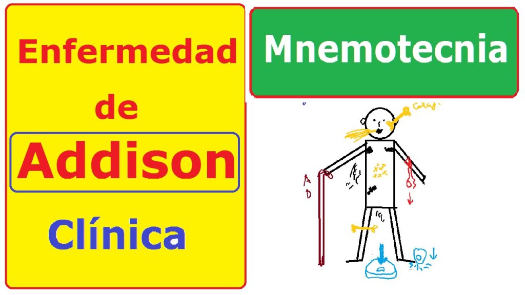 Todo lo que necesitas saber sobre la enfermedad de Addison: síntomas ...