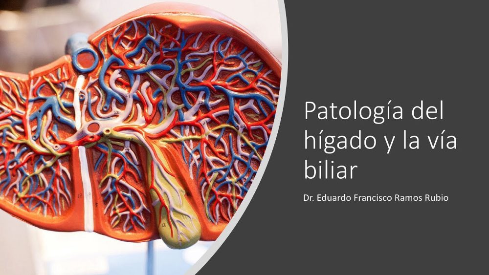 Descubre cómo identificar y tratar la patología hepatobiliar de manera ...