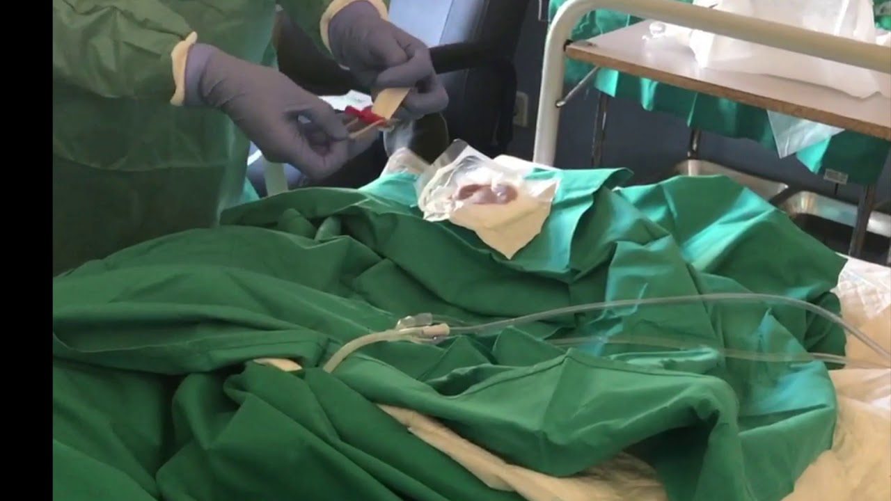 Todo lo que necesitas saber sobre la mitomicina: usos, dosis y efectos ...